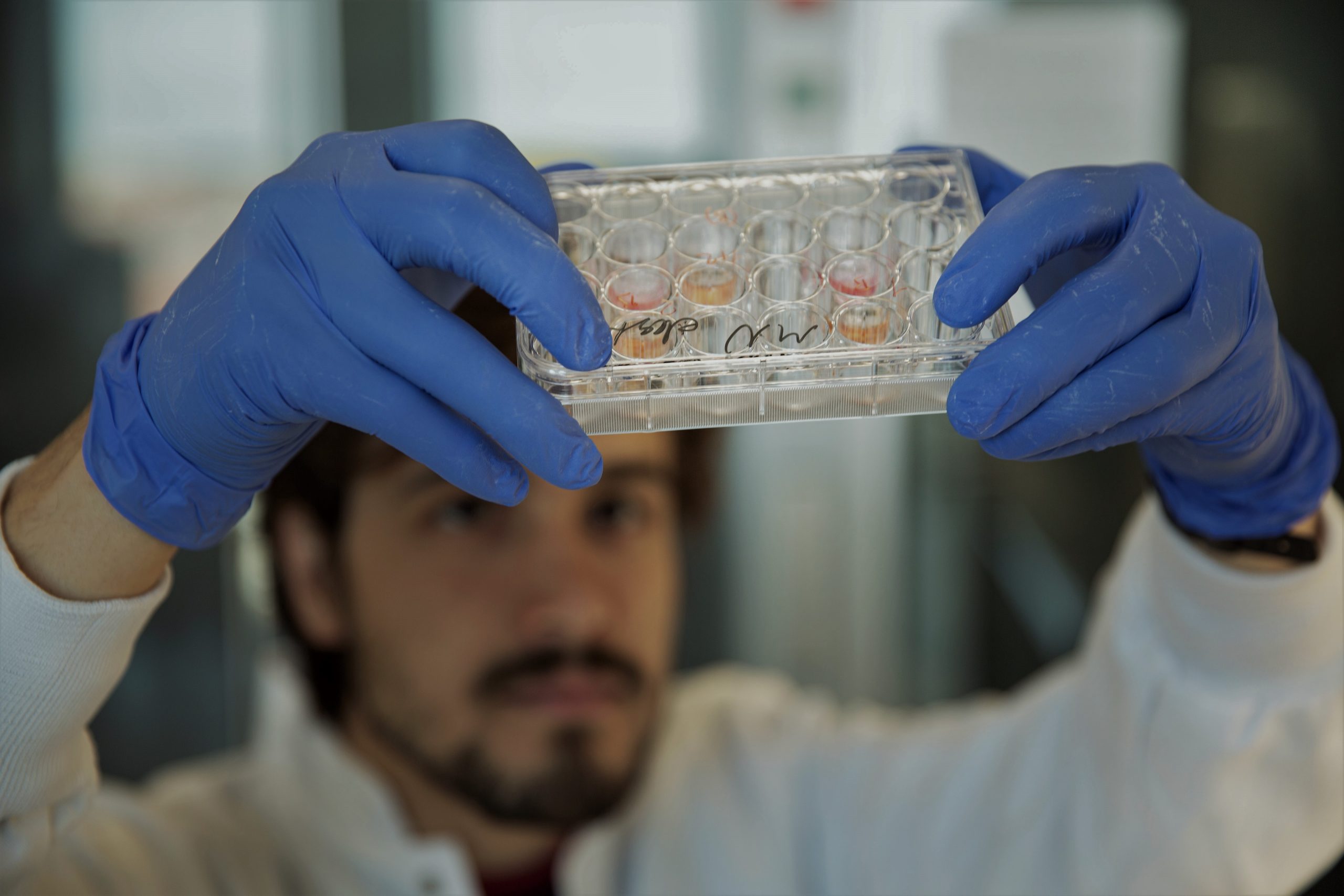 Skin tissue samples from 3,000 patients to give new insights into ...