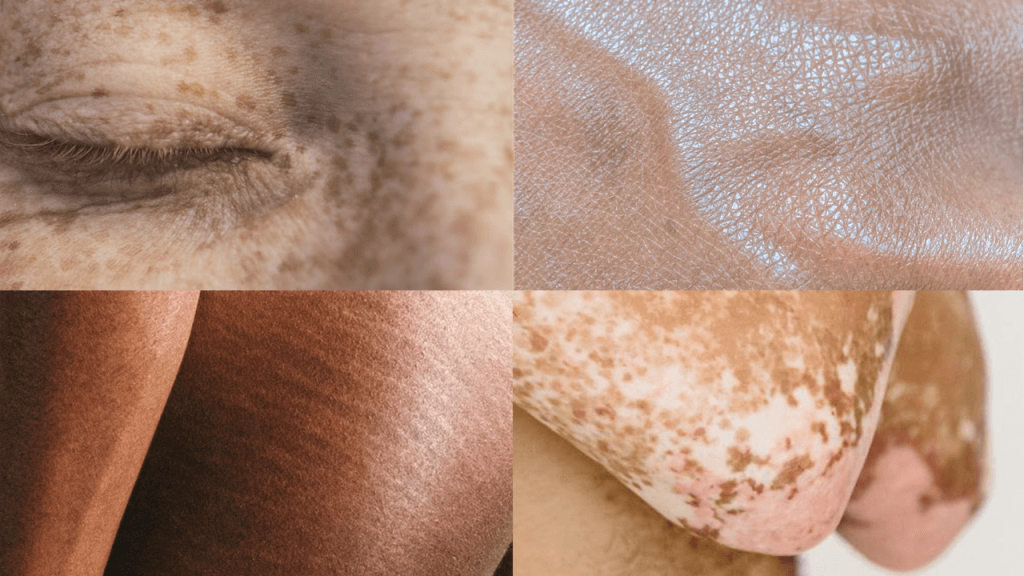 LEO Foundation launches campaign – Let’s talk about skin – to reshape ...